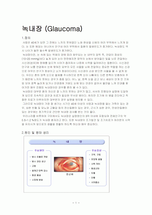 녹내장(케이스)