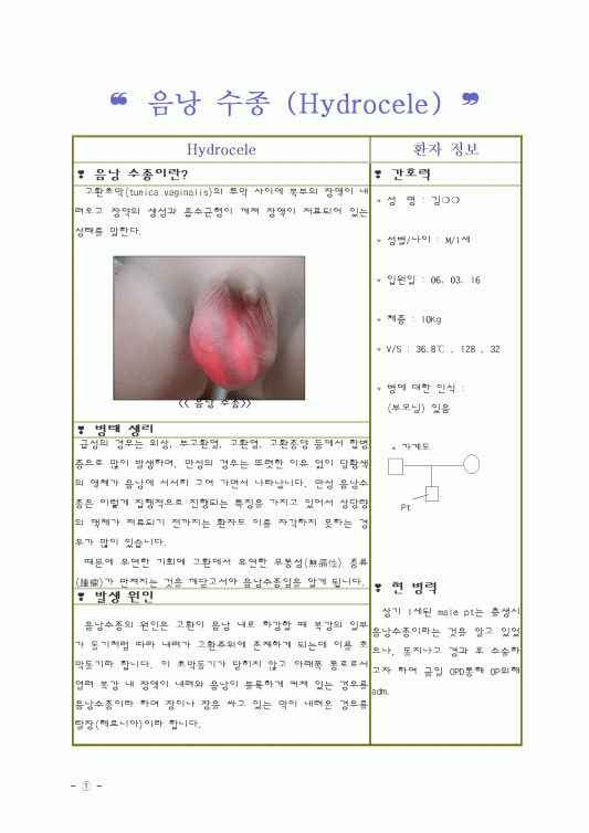 음낭 수종 레포트 자료
