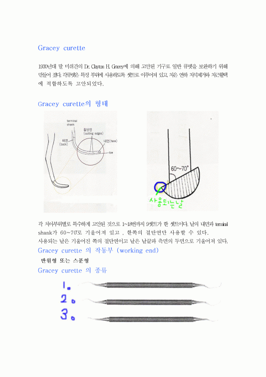 Gracey curette 레포트 자료