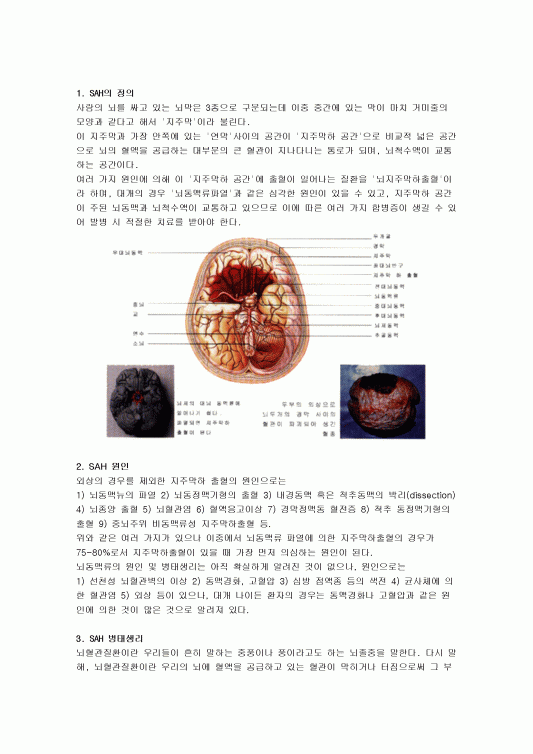 SAH 문헌고찰 레포트 자료