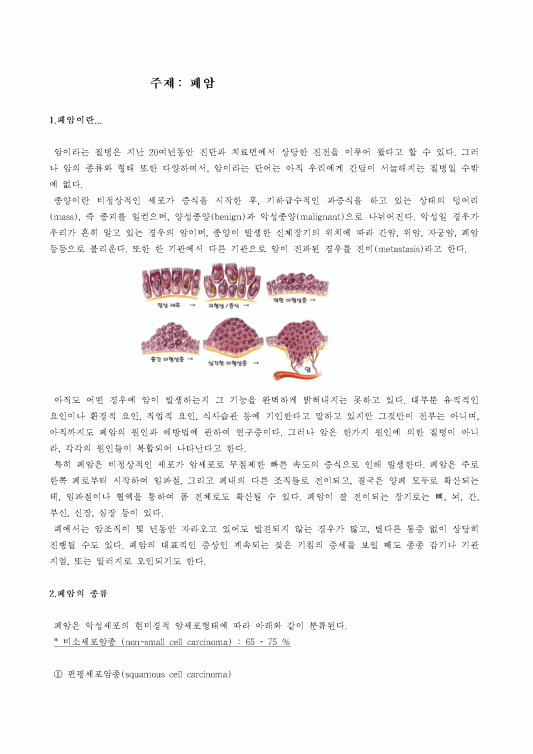인체와 질병 폐암