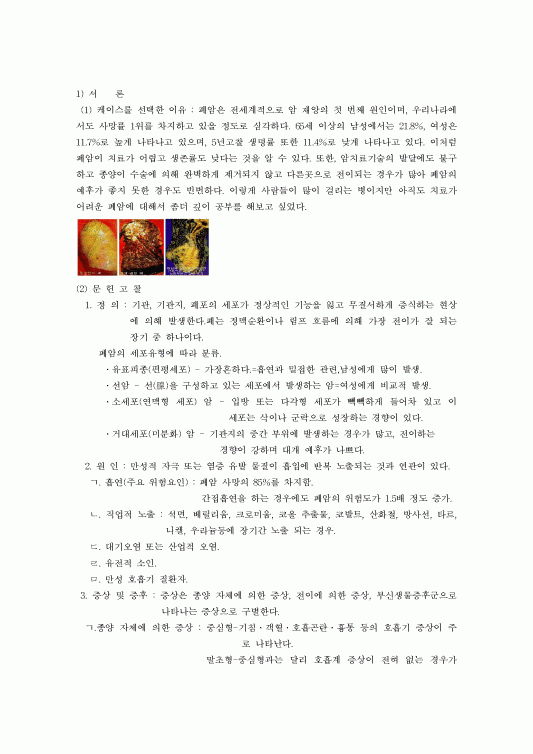 폐암 환자 레포트(수술실 레포트)
