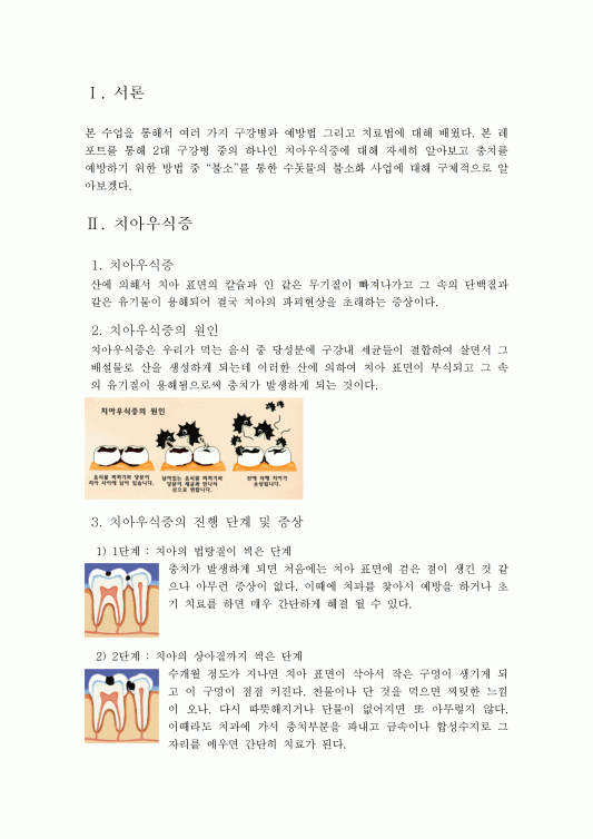 구강병과 예방법
