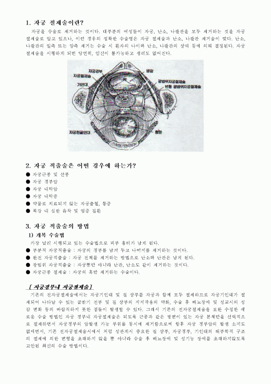 자궁 절제술 레포트 자료