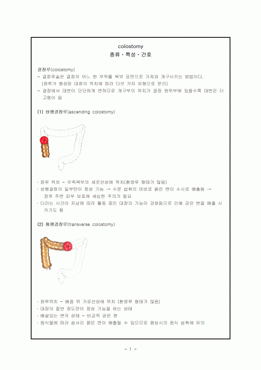 결장루술 레포트 자료