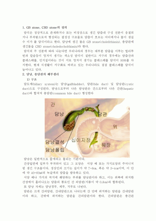 담석증과 총담관 결석 이해