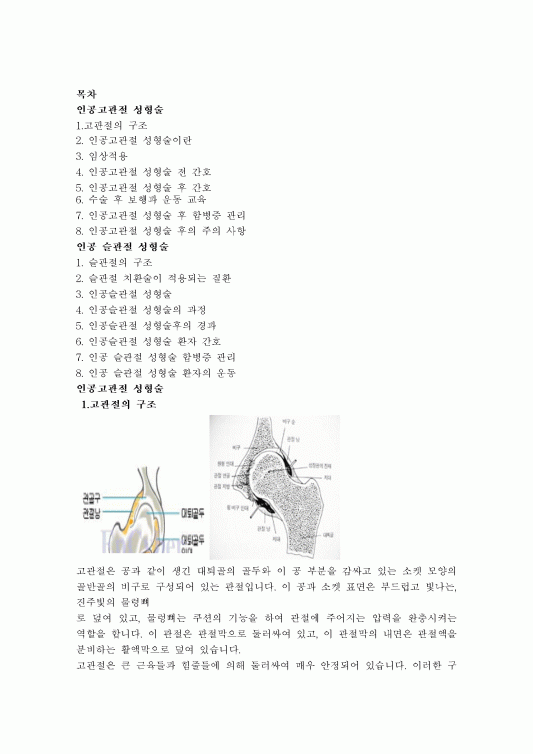 인공 관절 성형술
