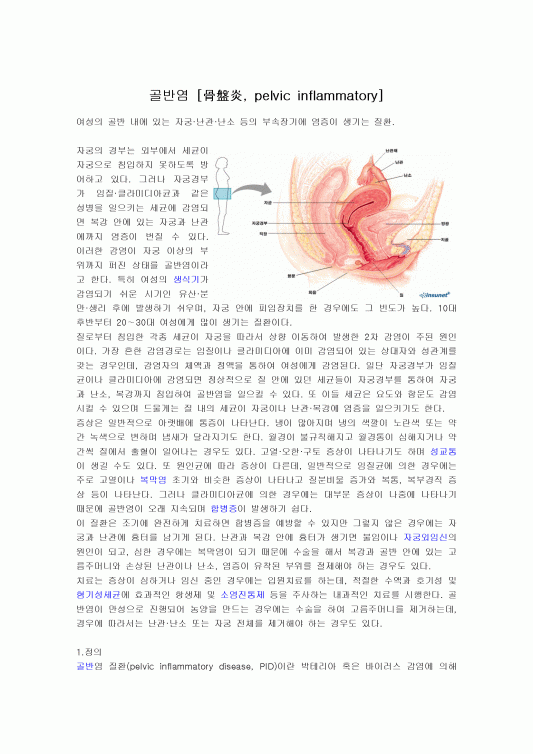 골반 내 염증성 질환 PID
