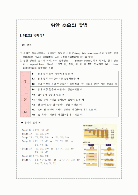 위암 수술의 종류