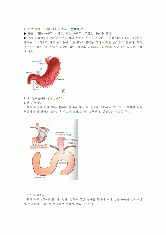 위 절제술 후 환자 식이