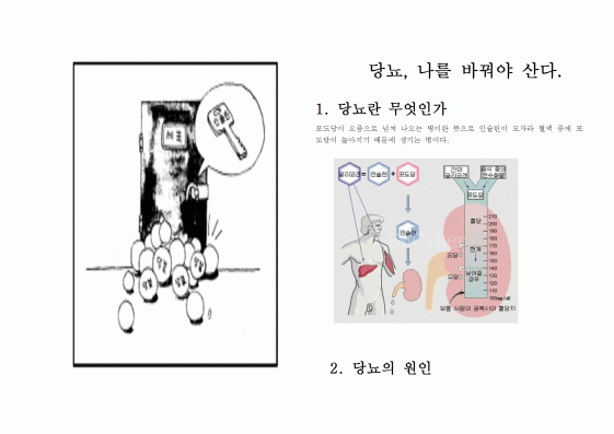당뇨와 치료 레포트 자료