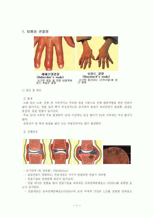 관절염의 종류와 간호