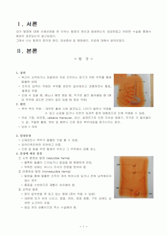탈장 hernia case study
