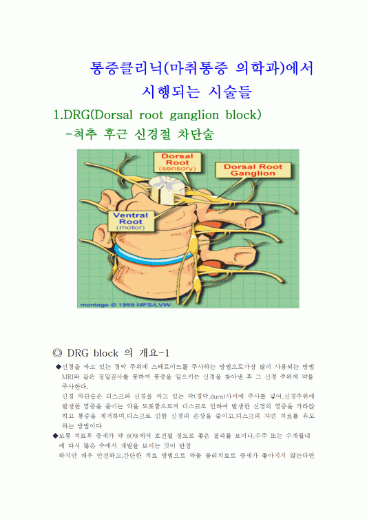 통증클리닉(DRG,TPI,SGB,CRPS-)