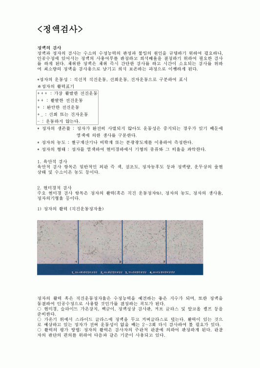 정액검사 레포트 자료