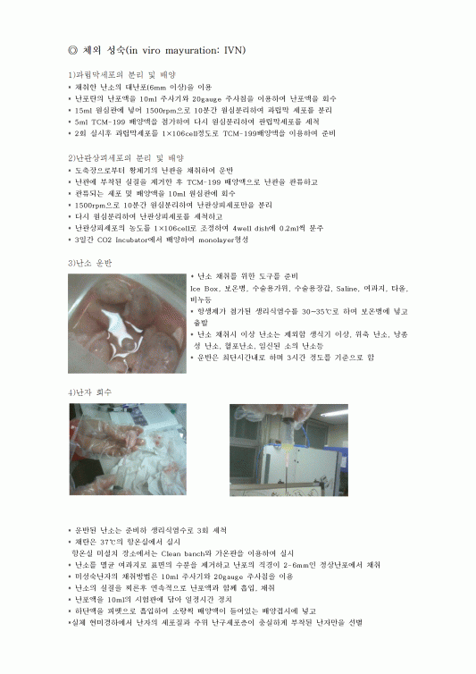 체외성숙 레포트 자료