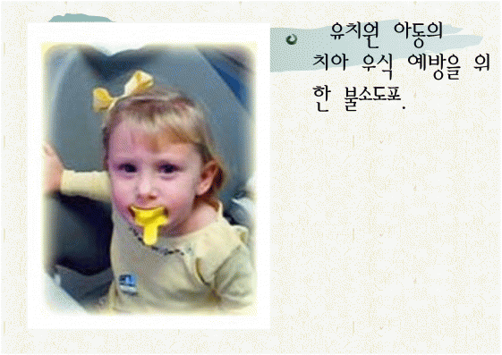 [치위생] 구강보건교육-불소도포 ppt