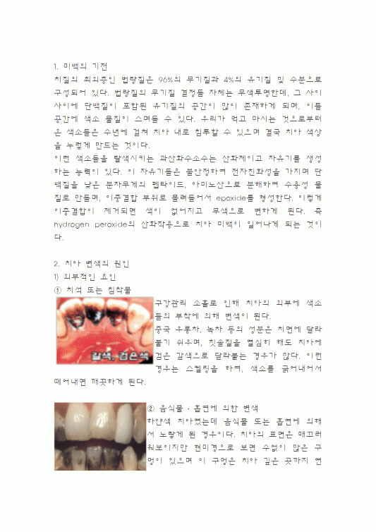 [치위생] 치아미백의 최신경향
