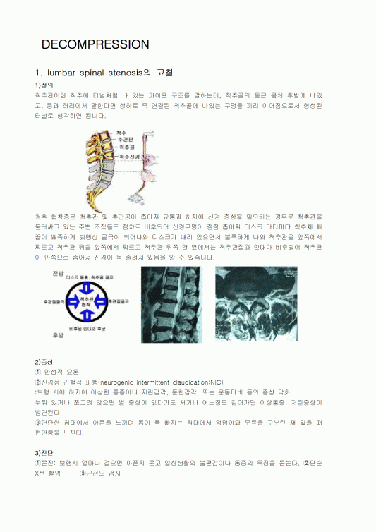 DECOMPRESSION 레포트 자료