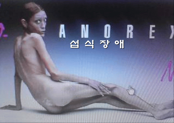섭식장애 설명 파워포인트