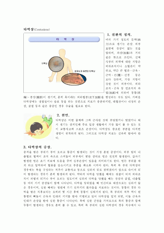 타박상(Contusions)의 원인과 증상 및 의학적 치료방법