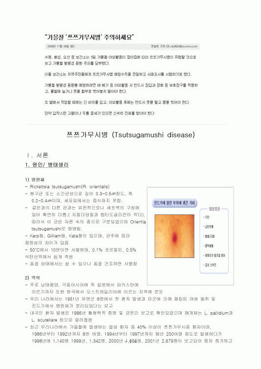 쯔쯔가무시 CASE 입니다