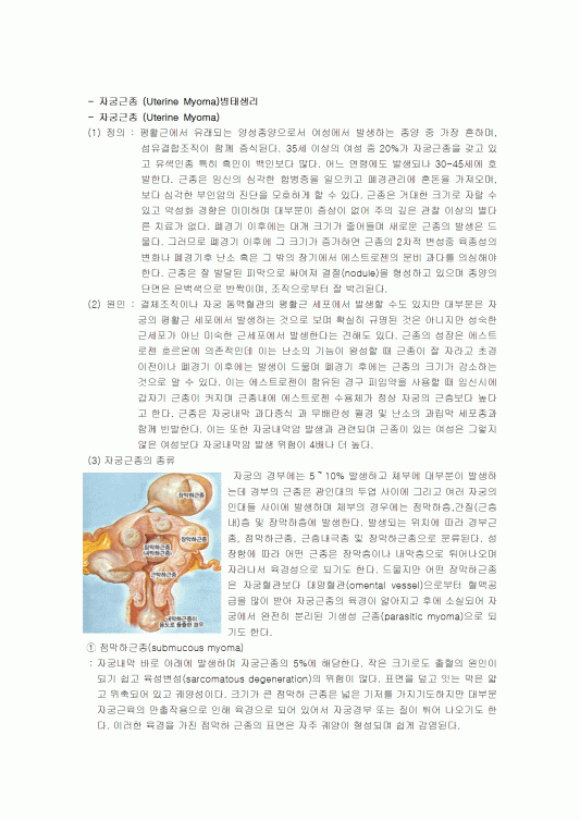 자궁근종 (Uterine Myoma)병태생리