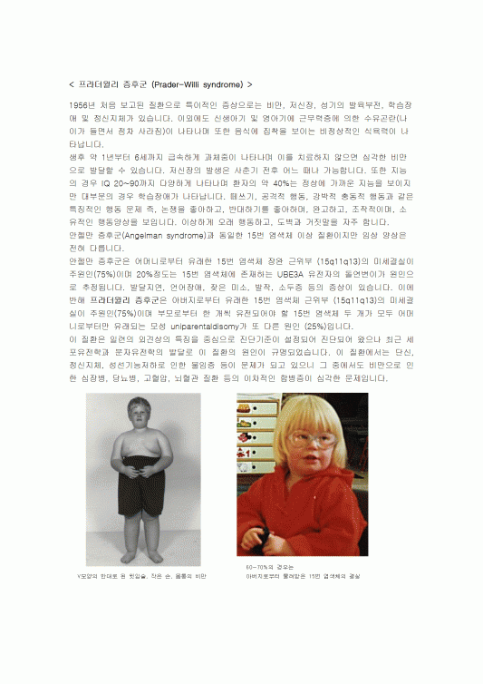 [생물학] 프라더윌리 증후군(Prader-Willi syndrome)에 대하여