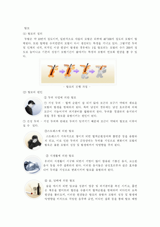 탈모에 대해 레포트 자료