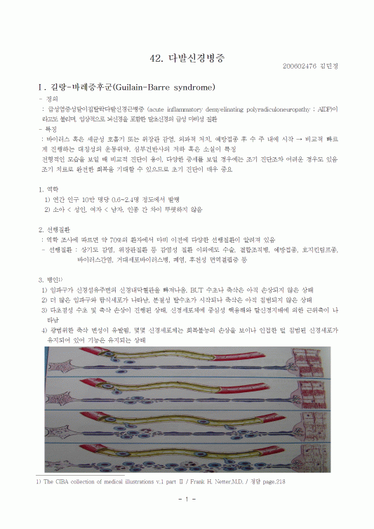 다발신경병증 (신경과학) (길랑바레 증후군)