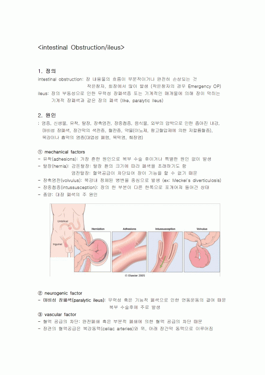 ileus 장폐색 레포트 자료