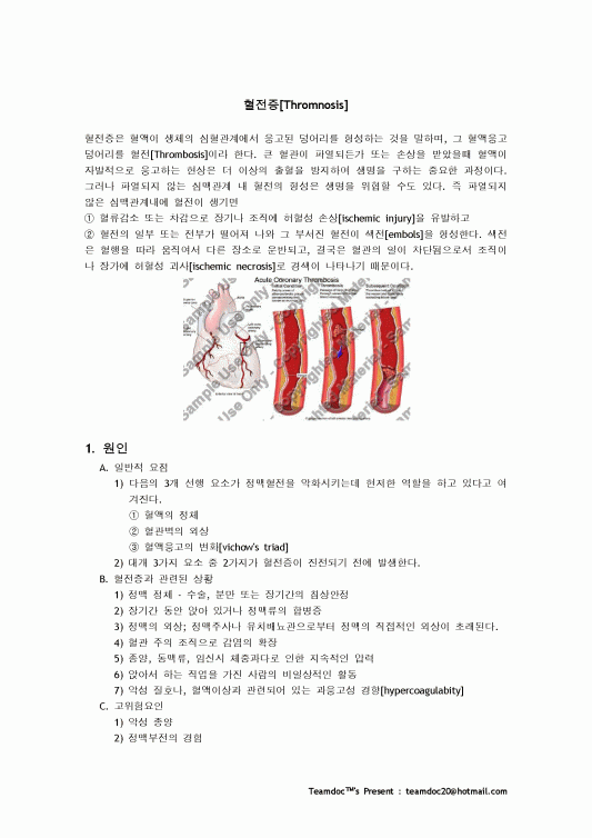 [간호] 혈전증