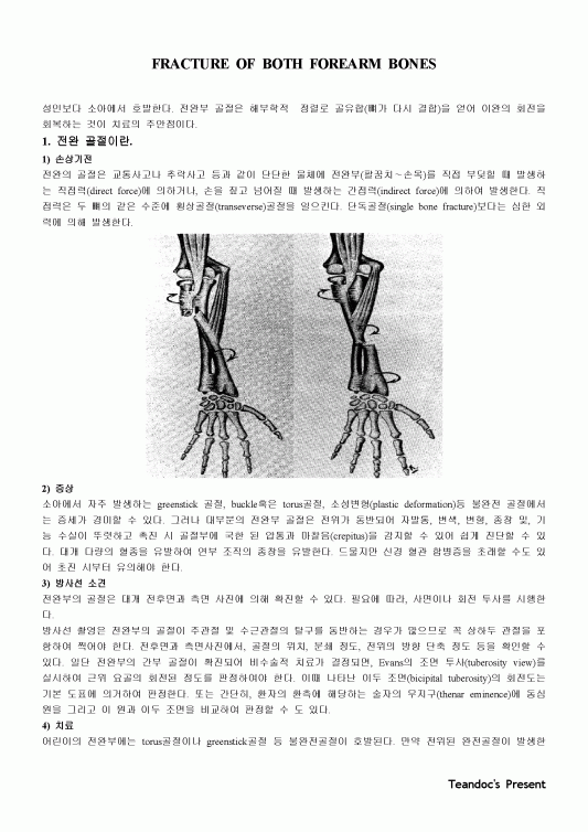 [물리치료] FRACTURE OF BOTH FOREARM BONES[전완 골절]