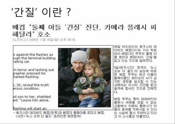 간질이란 무엇인가