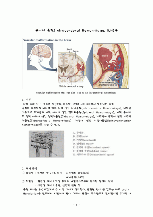 뇌내 출혈(Intracerebral Hemorrhage, ICH)
