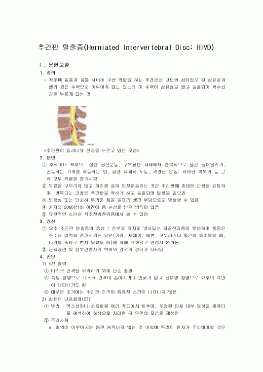 추간판탈출증