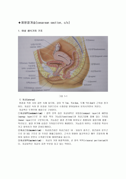 cesarean section 레포트 자료