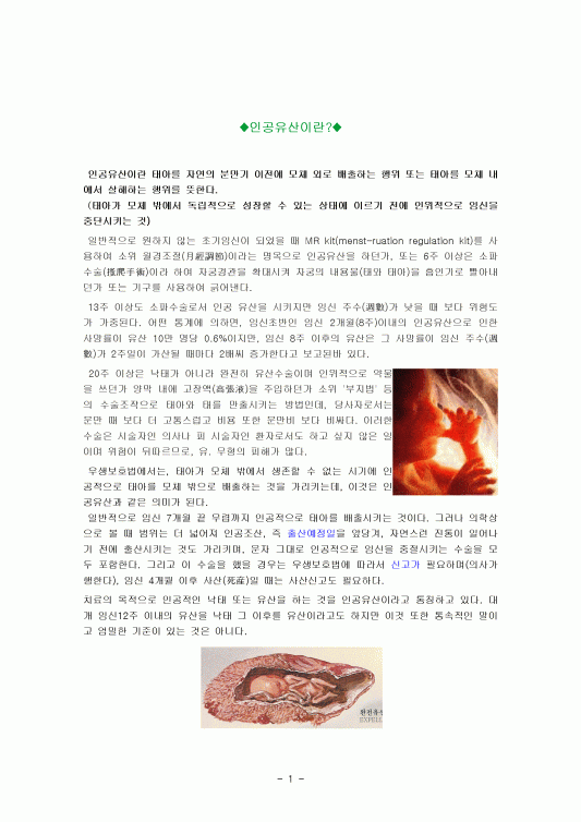 인공유산에 관한 정리와 이해