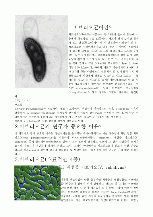 비브리오패혈증 - 비브리오균종류, 증상