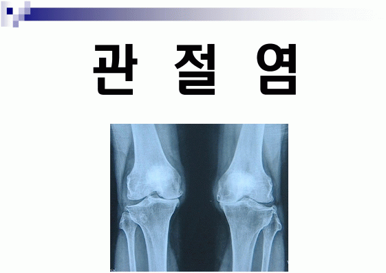 [관절염]노인교육자료 파워포인트입니다.