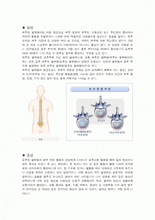 척추관협착증에 대한 문헌고찰