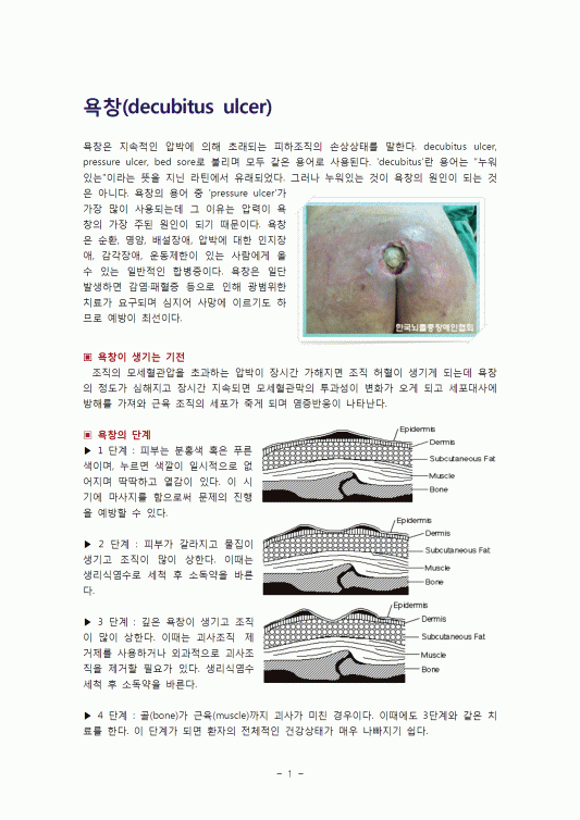 욕창(decubitus ulcer)