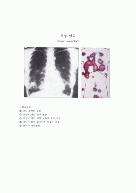 종양면역 (Tumor Immunology)