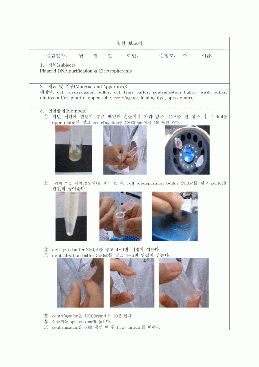 Plasmid DNA purification & Electrophoresis