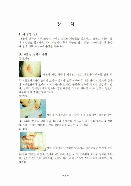 응급처치에 따른 상처간호