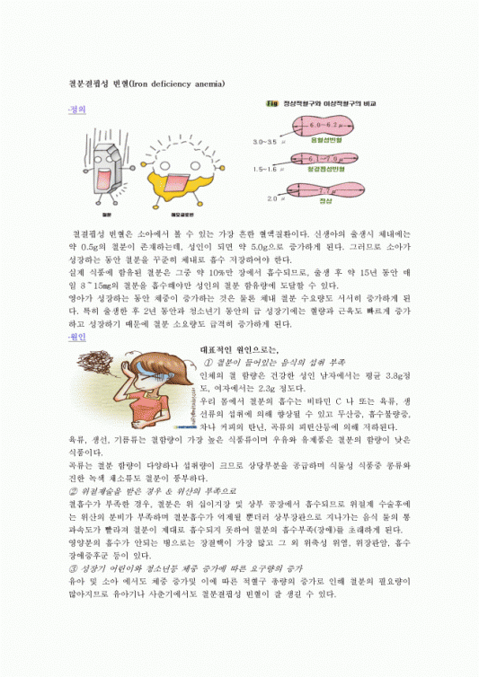 철분결핍성빈혈이란?