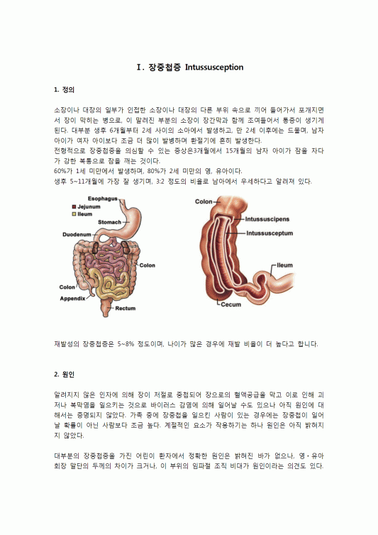 장중첩증 Intussusception