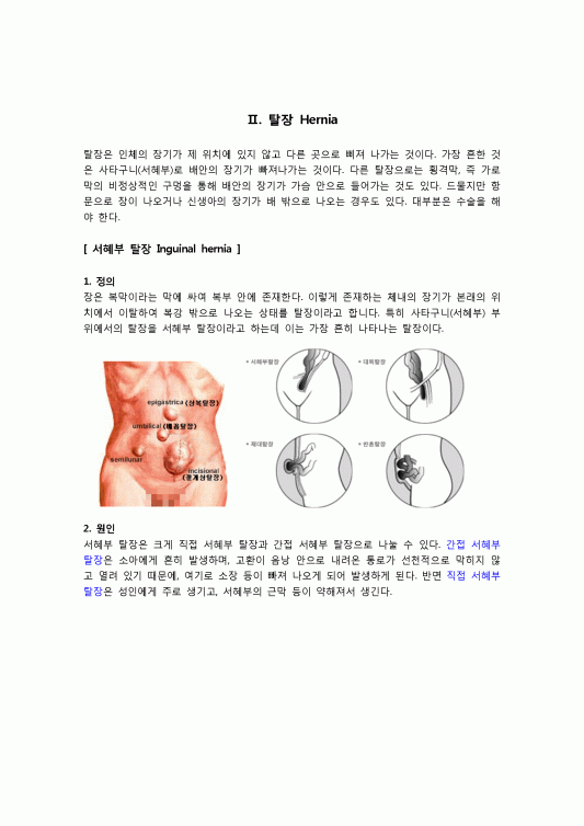 탈장 Hernia(서혜부탈장, 제대탈장)
