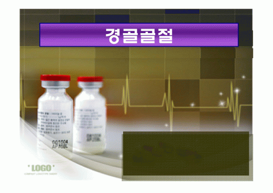 경골골절 문헌고찰/간호사정 ppt (사진많음)