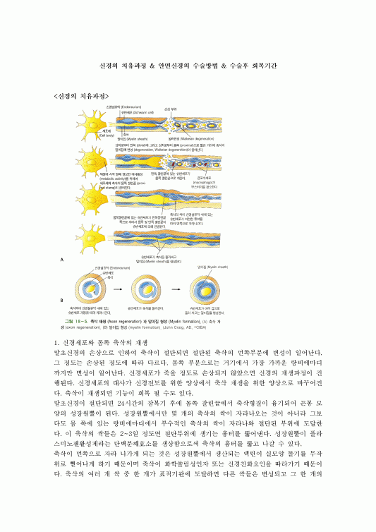 신경의 치유과정 & 안면신경의 수술방법 & 수술후 회복기간